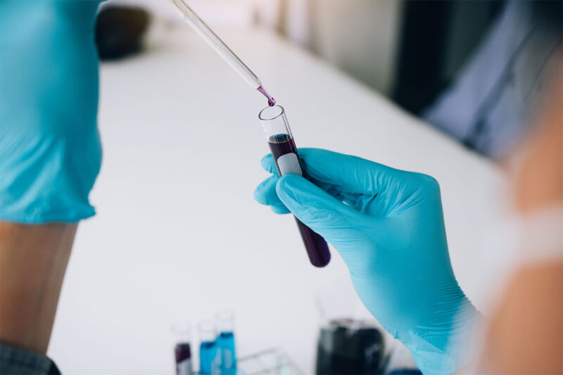 Blood Tests Adelaide | Haus of Holistic Health